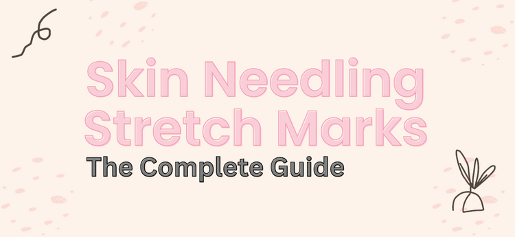 Skin Needling Stretch Marks | The Complete Microneedling Guide ...